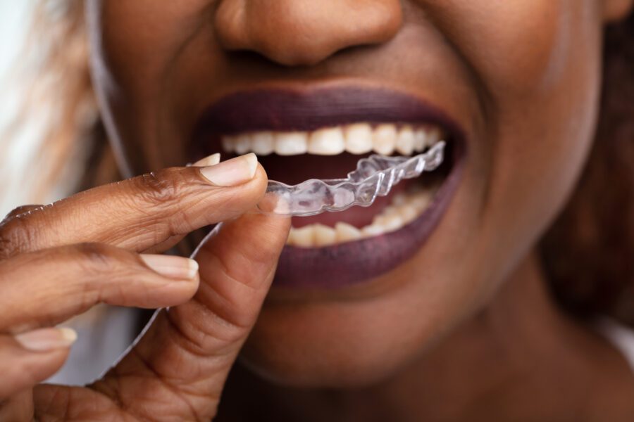Invisalign Hartland MI | Clear Braces Parshallville